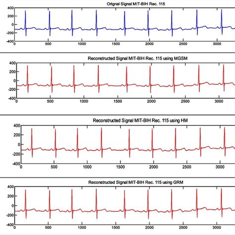 Set Of Reconstructed “rec 115” Signal Using Tchebichef Moments With Download Scientific