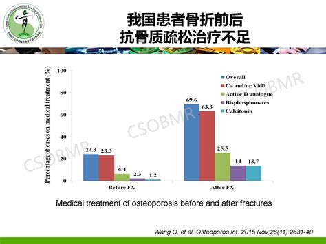 指南骨质疏松症流行病学发病机制 好医术早读文章 好医术 赋能医生守护生命