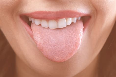 Scalloped Tongue Causes And Treatment