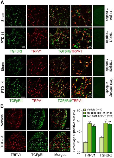 Peripheral Tgf β1 Signaling Is A Critical Event In Bone Cancer Induced