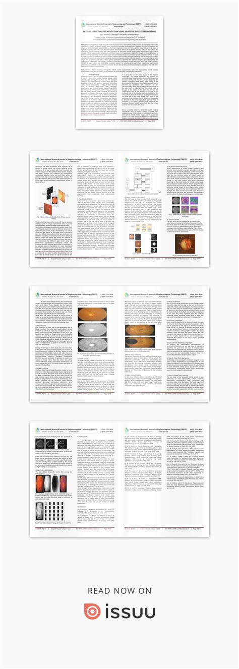 Irjet Retinal Structure Segmentation Using Adaptive Fuzzy Thresholding