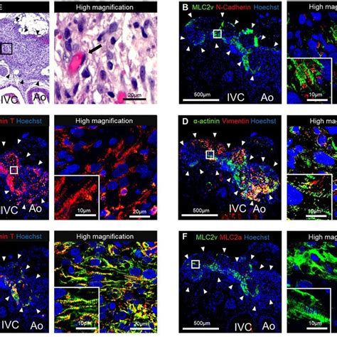 Histological Staining Of The Tubular Engineered Heart Tissues T Ehts Download Scientific