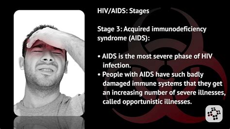 Hiv Infection Stages