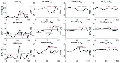 Results Of The One Way Repeated Measurement Anova Spm And Related