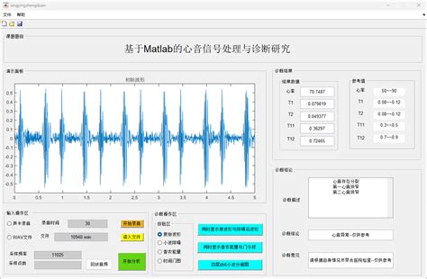 基于matlab的心音信号处理与诊断研究心电心音 分割心动周期 S1 S2 Matlab Csdn博客