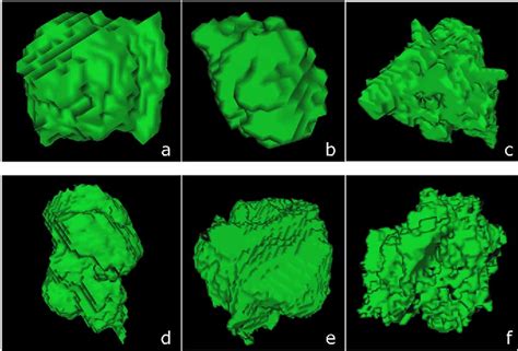 Figure 1 From Lung Lesion Extraction Using A Toboggan Based Growing Automatic Segmentation
