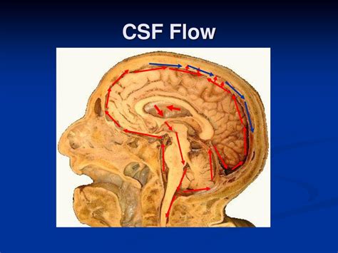 The Ventricular System Ppt Download
