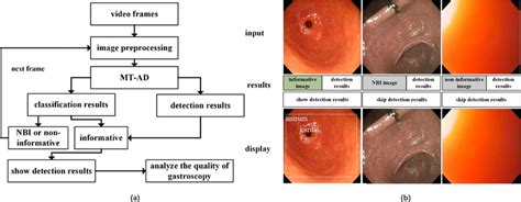 Upper Gastrointestinal Anatomy Detection With Multitask Convolutional Download Scientific
