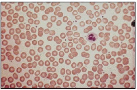 Frotis Sanguíneo Del Perro ¿qué Alteraciones Podemos Encontrar Cuas Formación Veterinaria