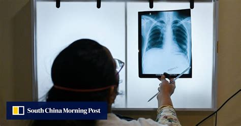 Is India Losing Its Fight Against Tuberculosis Eradication By 2025