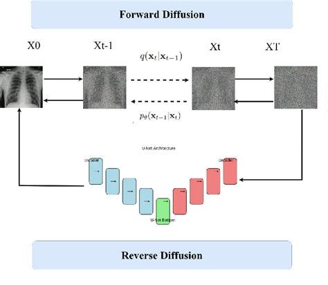 Figure 2 From Ssdma Self Supervised Diffusion Model For Lung Anomaly Detection Using Chest X