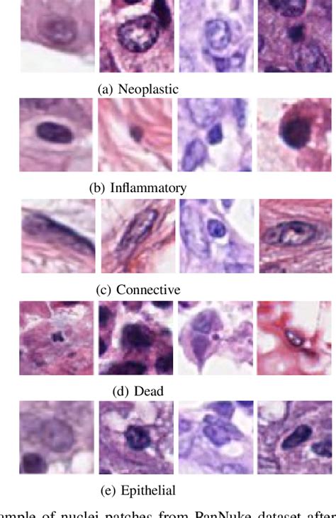 Figure 6 From Nuclei Classification In Histopathology Images Using Fuzzy Ensemble Of