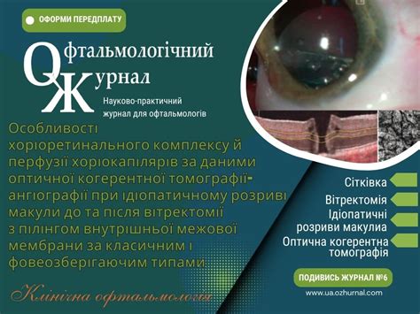 Features Of The Chorioretinal Complex And Perfusion Of The Choriocapillaries According To