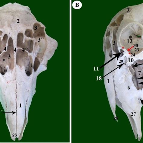 A And C Computed Tomography Image On The Left Side And B And D Download Scientific Diagram