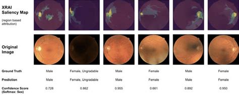 Region Based Saliency Maps For Model Prediction Colors Represent Download Scientific Diagram