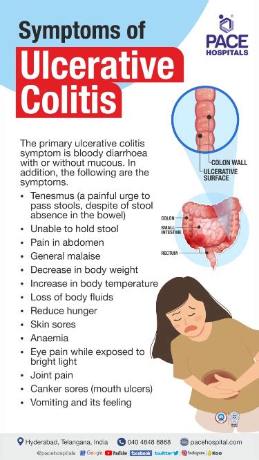 Best 13 Anal Fistula Symptoms Causes Types Complications Prevention Artofit