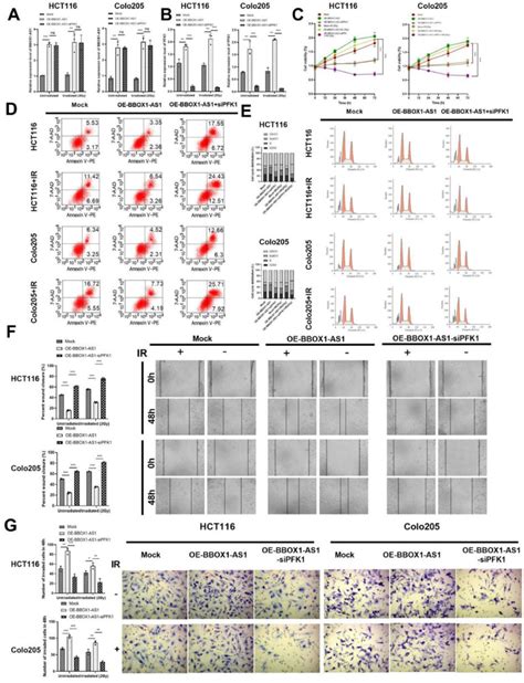 Long Noncoding Rna Bbox1 As1 Increased Radiotherapy Sensitivity In