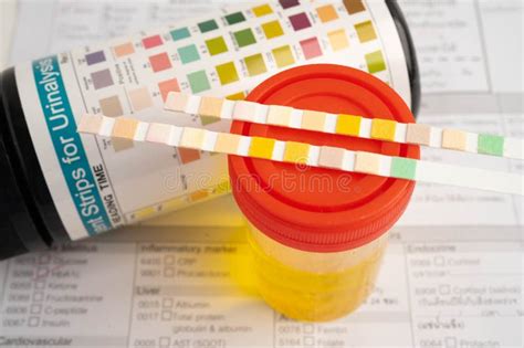 Urinalysis Urine Cup With Reagent Strip Ph Paper Test And Comparison