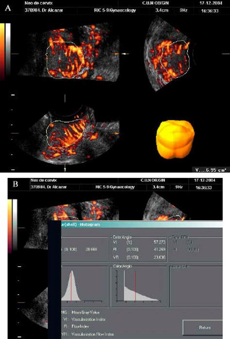 What Is Power In Ultrasound At William Henslowe Blog