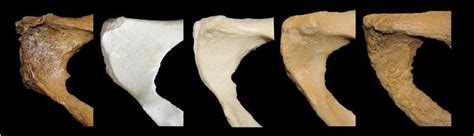 Ventral Arc Pelvis Ventral Arc Pelvis