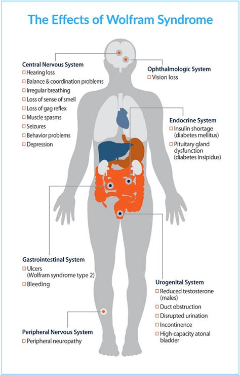 Wolfram Syndrome Explained The Snow Foundation