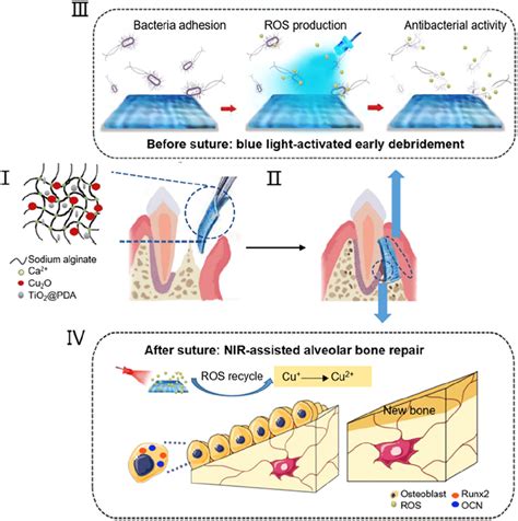 Schematic Diagram Of The Construction Of Ctp Sa And Gtr Surgery 62