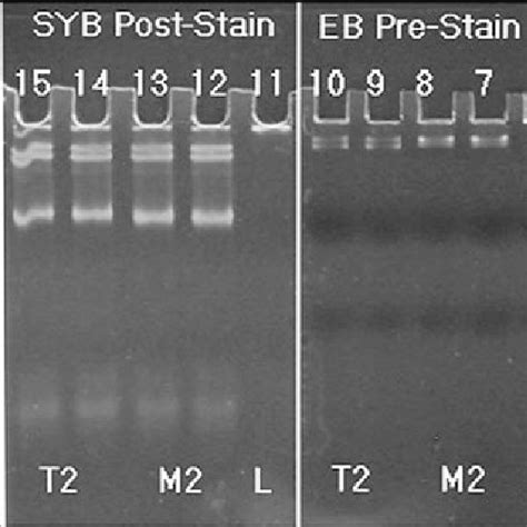 Four Single Strand Conformational Polymorphism Sscp Staining Methods