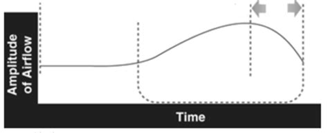 CSD Exam Flashcards Quizlet