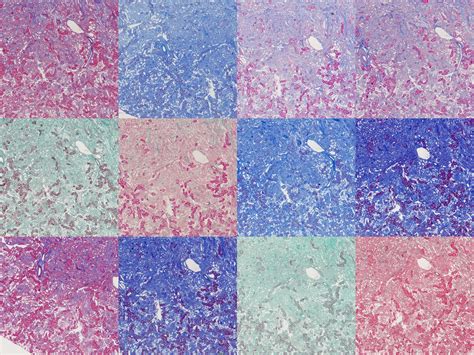 In Focus Massons Trichrome But Which One Bioimaging Hub News