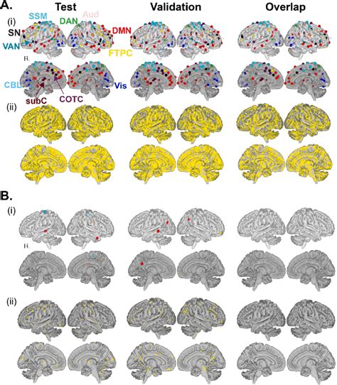 Performance Of The Pag Rois On Whole Brain Functional Connectivity A