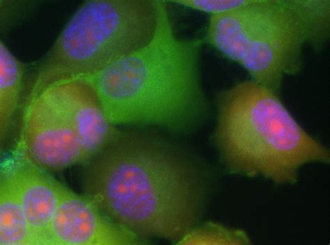 Nuclear Translocation Proteins Supplier