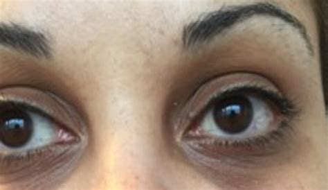 Focus On The Eyes Être Belle Australia
