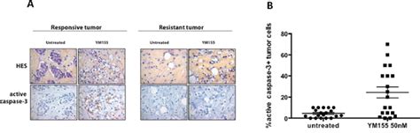 ym155 potently triggers cell death in breast cancer cells through an