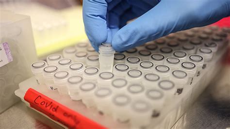 Testing And Collection Alberta Precision Laboratories