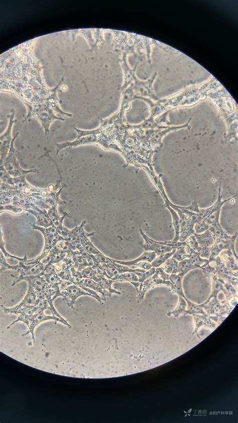 细胞污染 丁香园论坛