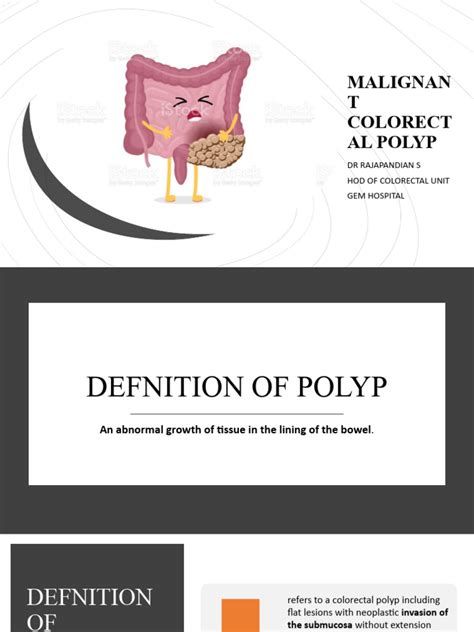Malignant Colorectal Polyp Download Free Pdf Colorectal Cancer Neoplasms