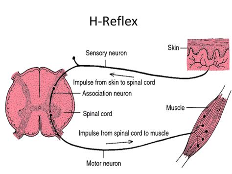 Late Responses F Wave And Hreflex Ppt