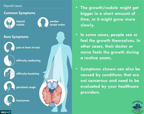 Thyroid Cancer Signs Symptoms And Complications 41 Off