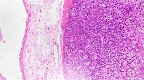 Adrenal Gland Of Human Being In Section Filmed Under Microscope 200x