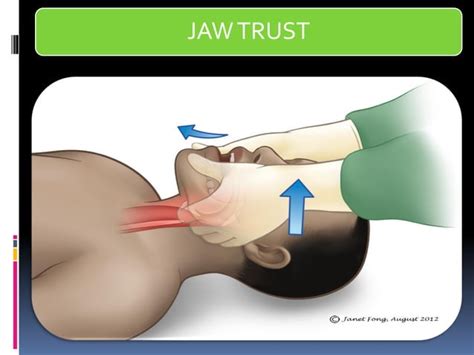 Atls Initial Assessment 2019 Pdf First Aid Injuries
