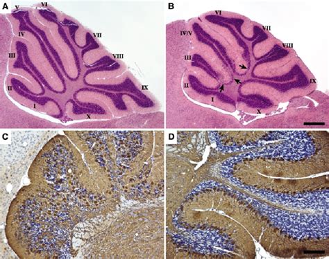 Cerebellar Defects In Mthfr Deficient Mice Hematoxylin And Download Scientific Diagram
