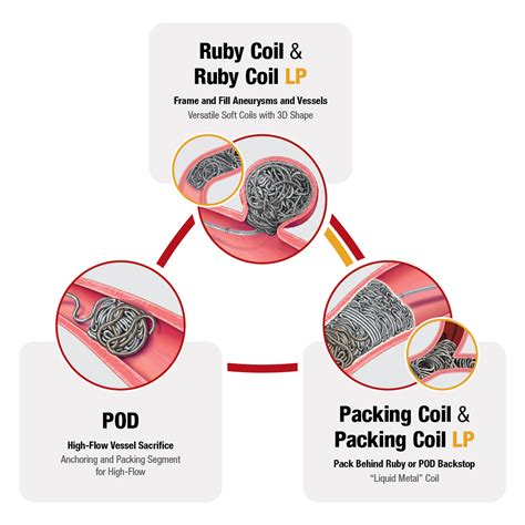 Peripheral Embolization Penumbra Inc