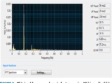 Figure 2 From Ecg Signal Preprocessing And Svm Classifier Based Abnormality Detection In Remote