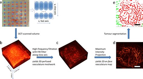 Octoca Data Acquisition And Signal Processing Overview A White