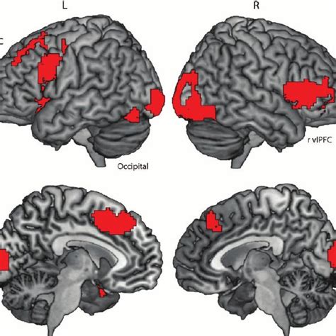 Results Of The Task Choice Decoding Analysis A Spatial Activation