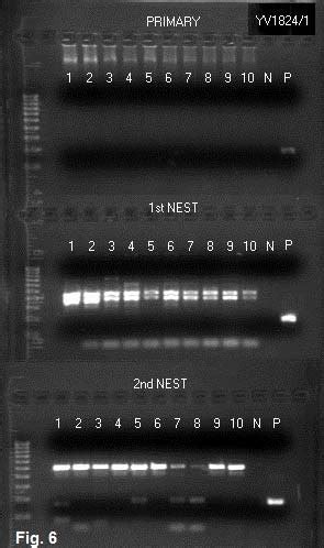 Third Same Nested PCR In Preparation Of An HPV 16 Gene DNA Template For