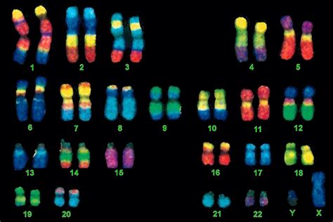 Sex Chromosome Variants Are Not Their Own Unique Sexes
