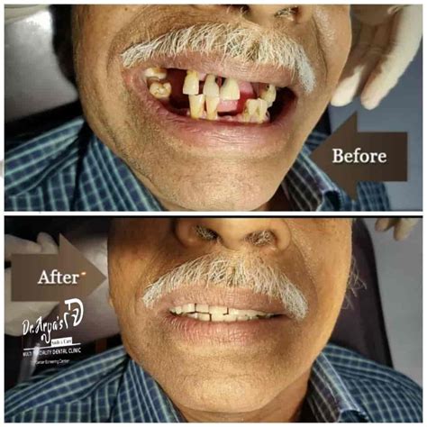 Dr Aryas Smile And Care Dental Clinic In Kurampala Southpathanamthitta Best Dental Clinics In