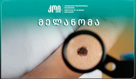 კანის მელანომა ჯანმრთელობა Vidal Ge