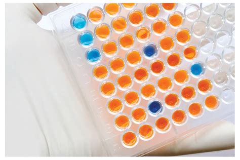 Multiplex Immunoassay Market Trendsciteab Blog